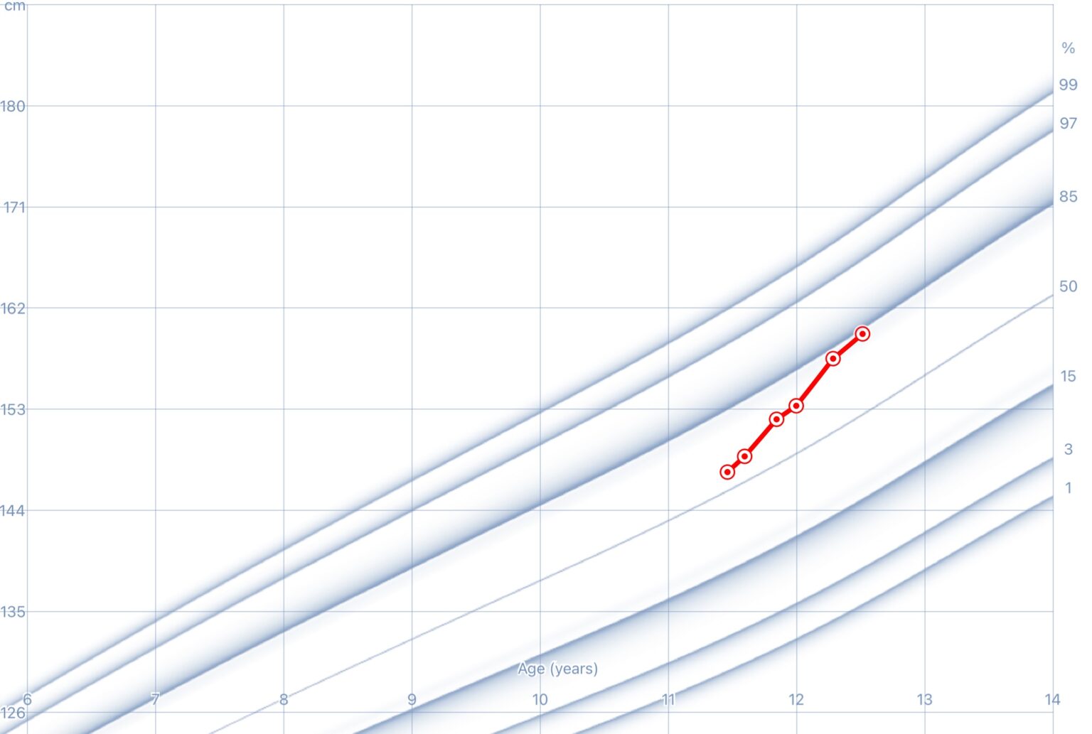 What Age Do Growth Plates Close? - I Grow Clinic